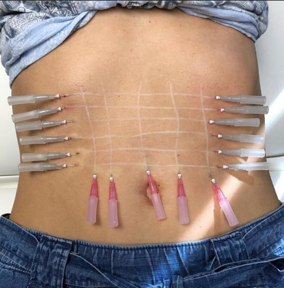 PDO BODY THREADS TRAINING PACKAGE – Online Depot Store